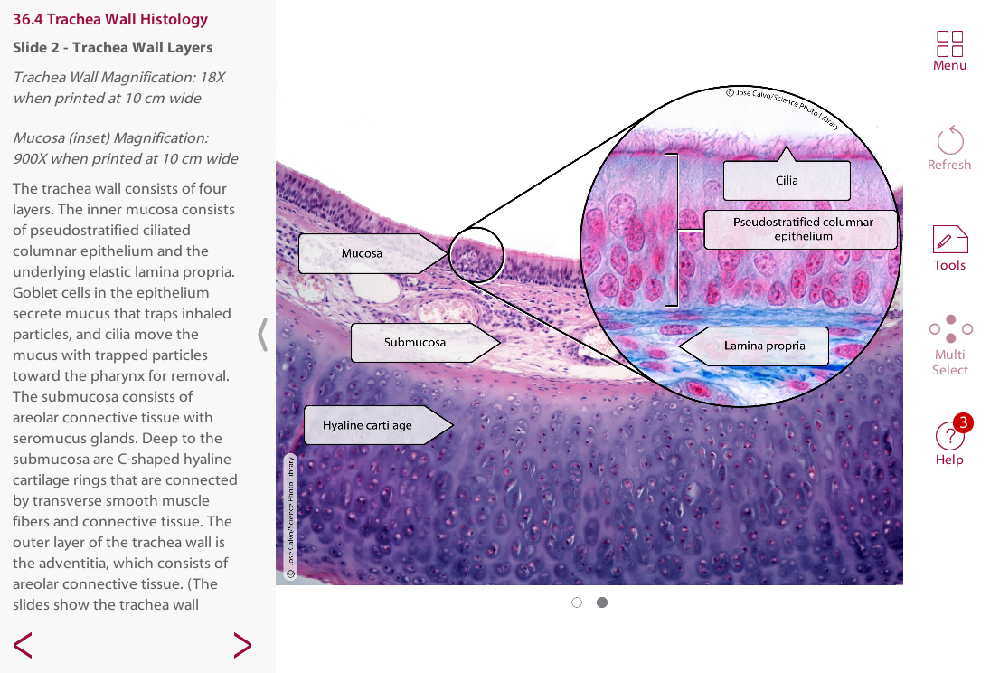 VISIBLE BODY – Science Photo Library