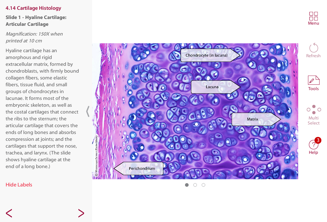 VISIBLE BODY – Science Photo Library