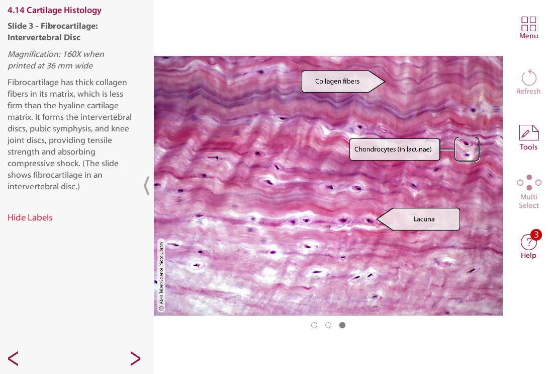 VISIBLE BODY – Science Photo Library